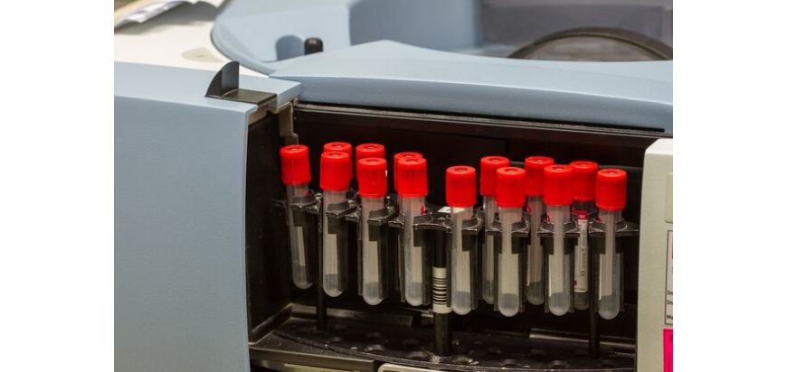 Understanding The Significance Of Blood Storage Device Market - ReportPrime